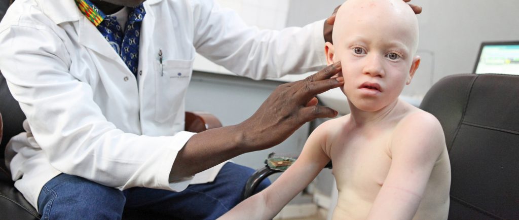 National Hospital Has Treated 5,500 Albinism Skin Cancer Patients ...